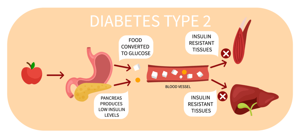 Diabetes Basics - Hunter Diabetes Centre